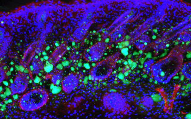 UC San Diego Researchers Identify How Skin Ages, Loses Fat and Immunity ...